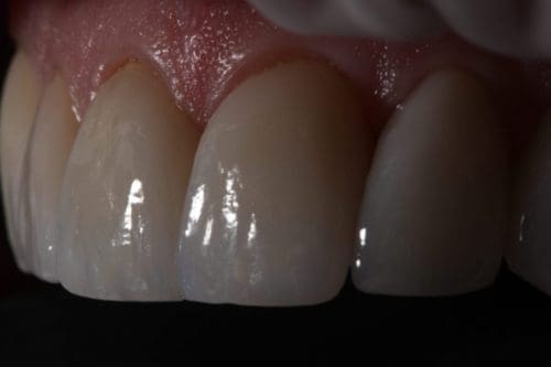 Dentist Mt. Pleasant MI | Cosmetic Dentistry | Raymond Ribitch DDS