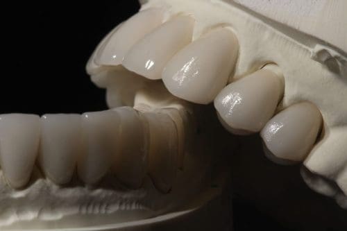 Dentist Mt. Pleasant MI | Cosmetic Dentistry | Raymond Ribitch DDS