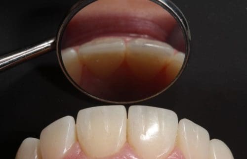 Dentist Mt. Pleasant MI | Cosmetic Dentistry | Raymond Ribitch DDS